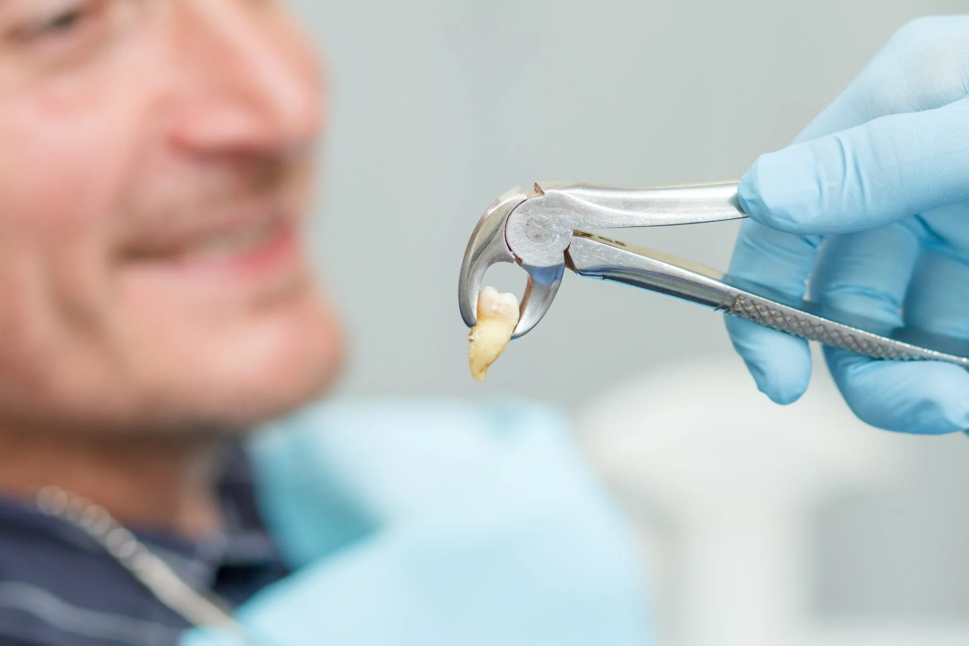 Healing Timeline After Tooth Removal | Apex Dental Studio